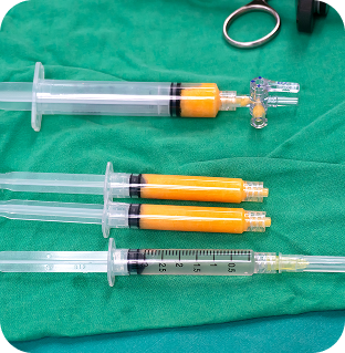 Brazilian Butt Lift (BBL) | Valespring | Greater Toronto Area